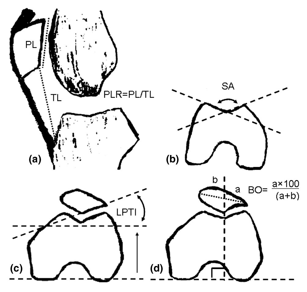 The association between patellar alignment on magnetic resonance ...