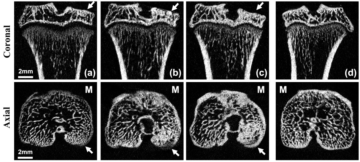 Application of in vivo micro-computed tomography in the temporal ...