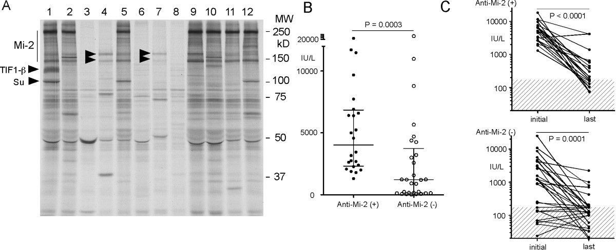 Implications in the difference of anti-Mi-2 and -p155/140 autoantibody ...