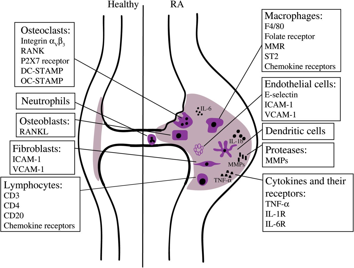 Molecular imaging of rheumatoid arthritis: emerging markers, tools, and ...