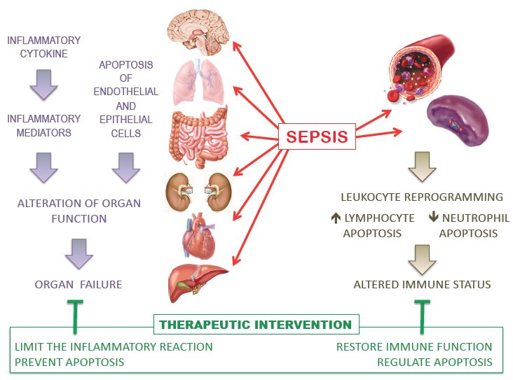 Is boosting the immune system in sepsis appropriate? | Critical Care ...