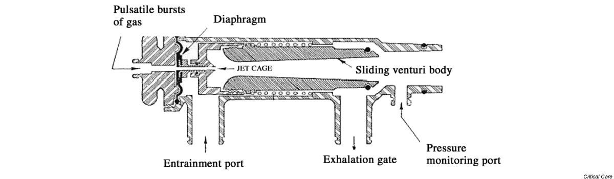 Intrapulmonary percussive ventilation in acute exacerbations of COPD ...