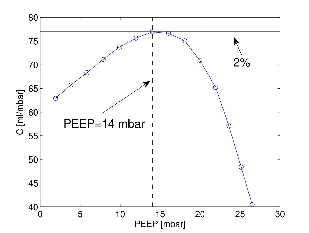 PEEP titration guided by ventilation homogeneity: a feasibility study ...