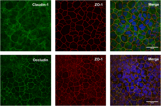 Visualisation of Multiple Tight Junctional Complexes in Human Airway ...