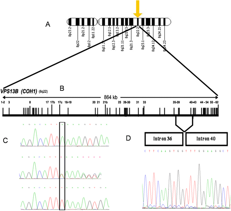 Novel VPS13B Mutations in Three Large Pakistani Cohen Syndrome Families ...