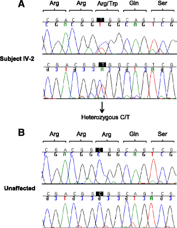 Partial nephrogenic diabetes insipidus caused by a novel AQP2 variation ...