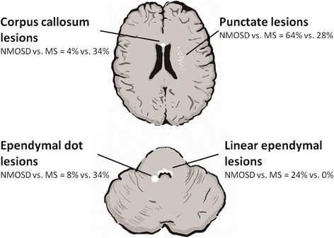 Comparison between the cranial magnetic resonance imaging features of neuromyelitis optica ...