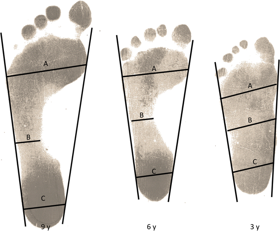 Comparisons of foot anthropometry and plantar arch indices between ...