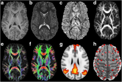 Developmental brain trajectories in children with ADHD and controls: a ...