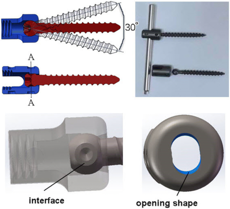 Investigation into the biomechanics of lumbar spine micro-dynamic ...