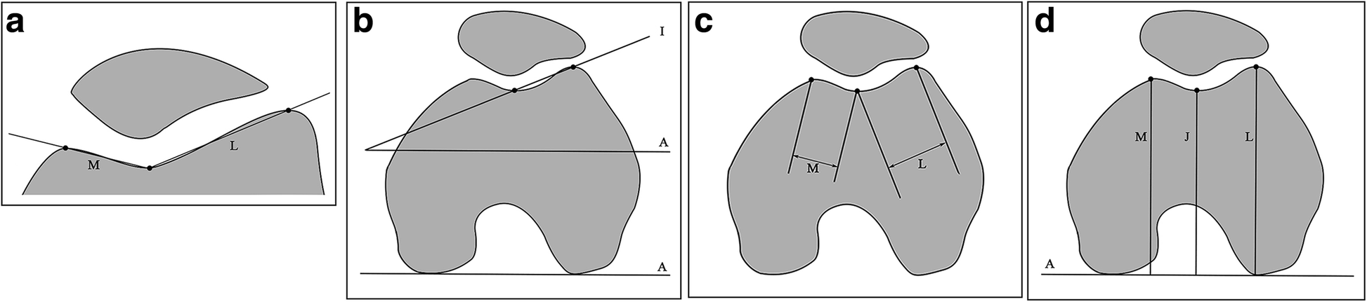 Patellar instability: the reliability of magnetic resonance imaging ...