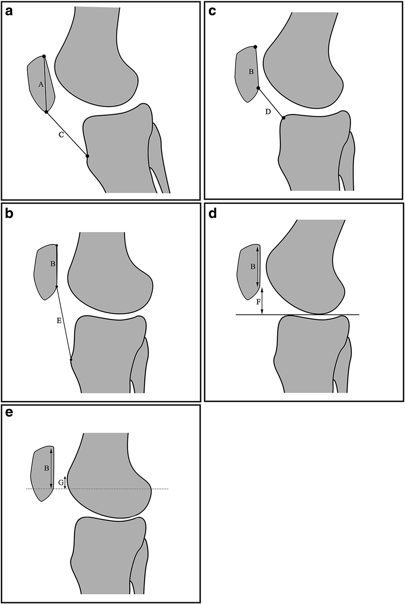 Patellar instability: the reliability of magnetic resonance imaging ...