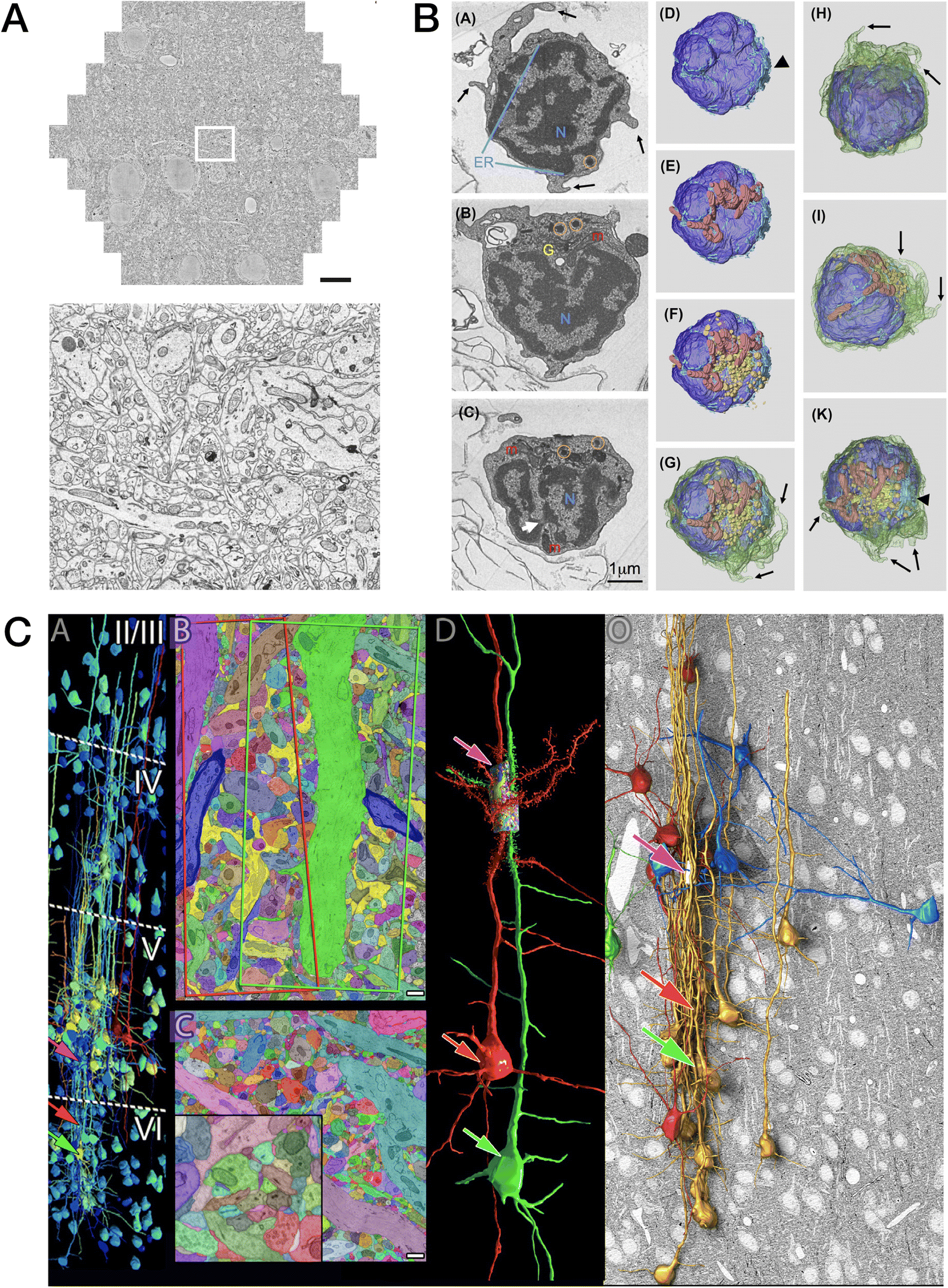 Q&A: Array tomography | BMC Biology | Full Text