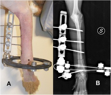 Evaluation of sixty-eight cases of fracture stabilisation by external ...