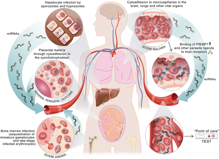 Tying malaria and microRNAs: from the biology to future diagnostic ...