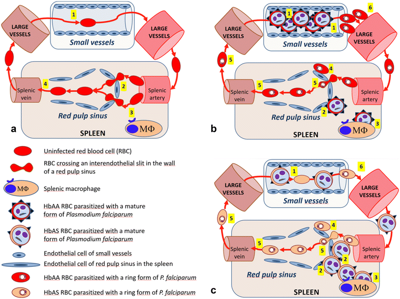 Stage-dependent fate of Plasmodium falciparum-infected red blood cells ...