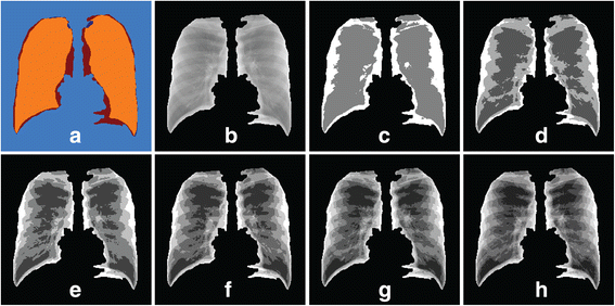 Lung segmentation on standard and mobile chest radiographs using ...