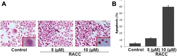 Glycol chitosan incorporated retinoic acid chlorochalcone (RACC ...