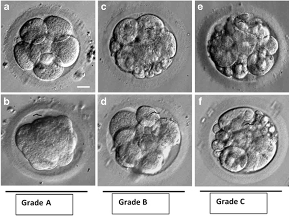 Different effectiveness of closed embryo culture system with time-lapse ...