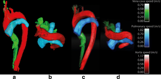 Atlas-based analysis of 4D flow CMR: Automated vessel segmentation and flow quantification ...