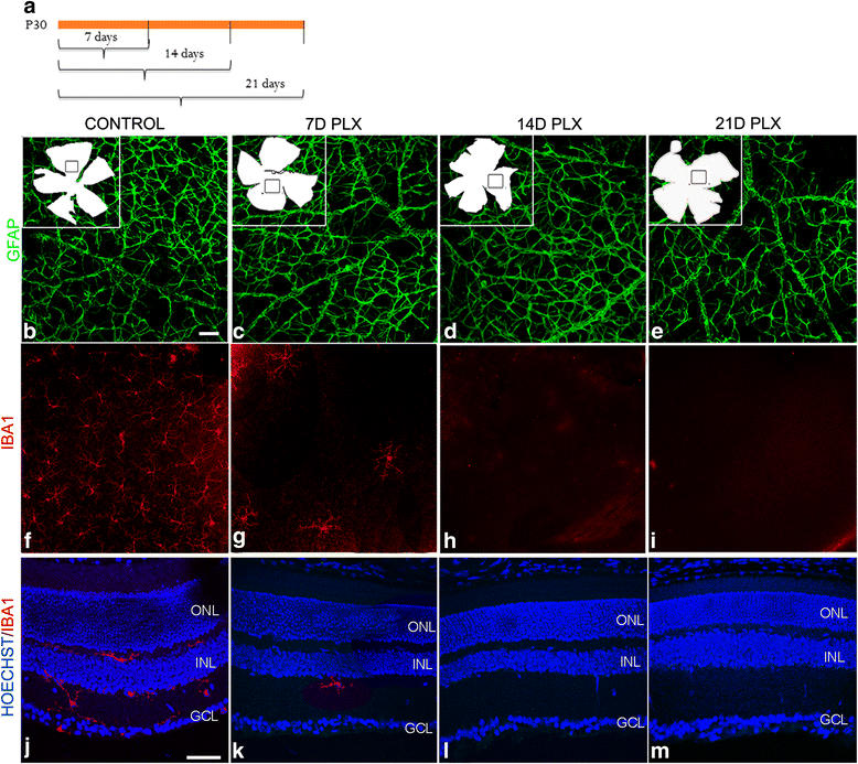 Microglia activation is essential for BMP7-mediated retinal reactive ...