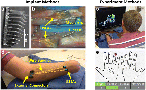 Restoration of motor control and proprioceptive and cutaneous sensation ...