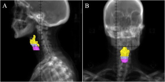 Development of a standardized method for contouring the larynx and its ...