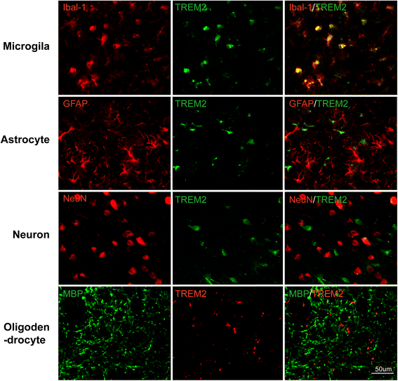 TREM2 protects against cerebral ischemia/reperfusion injury | Molecular ...