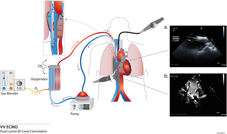 Echocardiography for adult patients supported with extracorporeal membrane oxygenation ...
