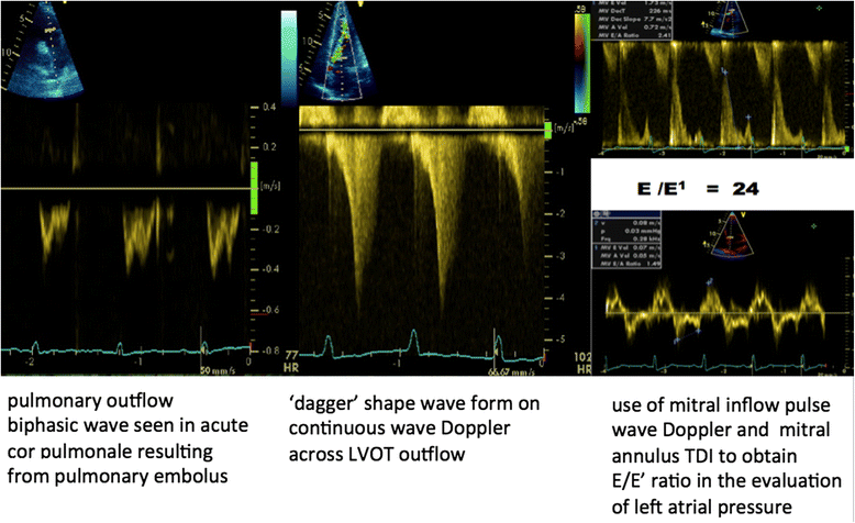 Echocardiography in shock management | Critical Care | Full Text