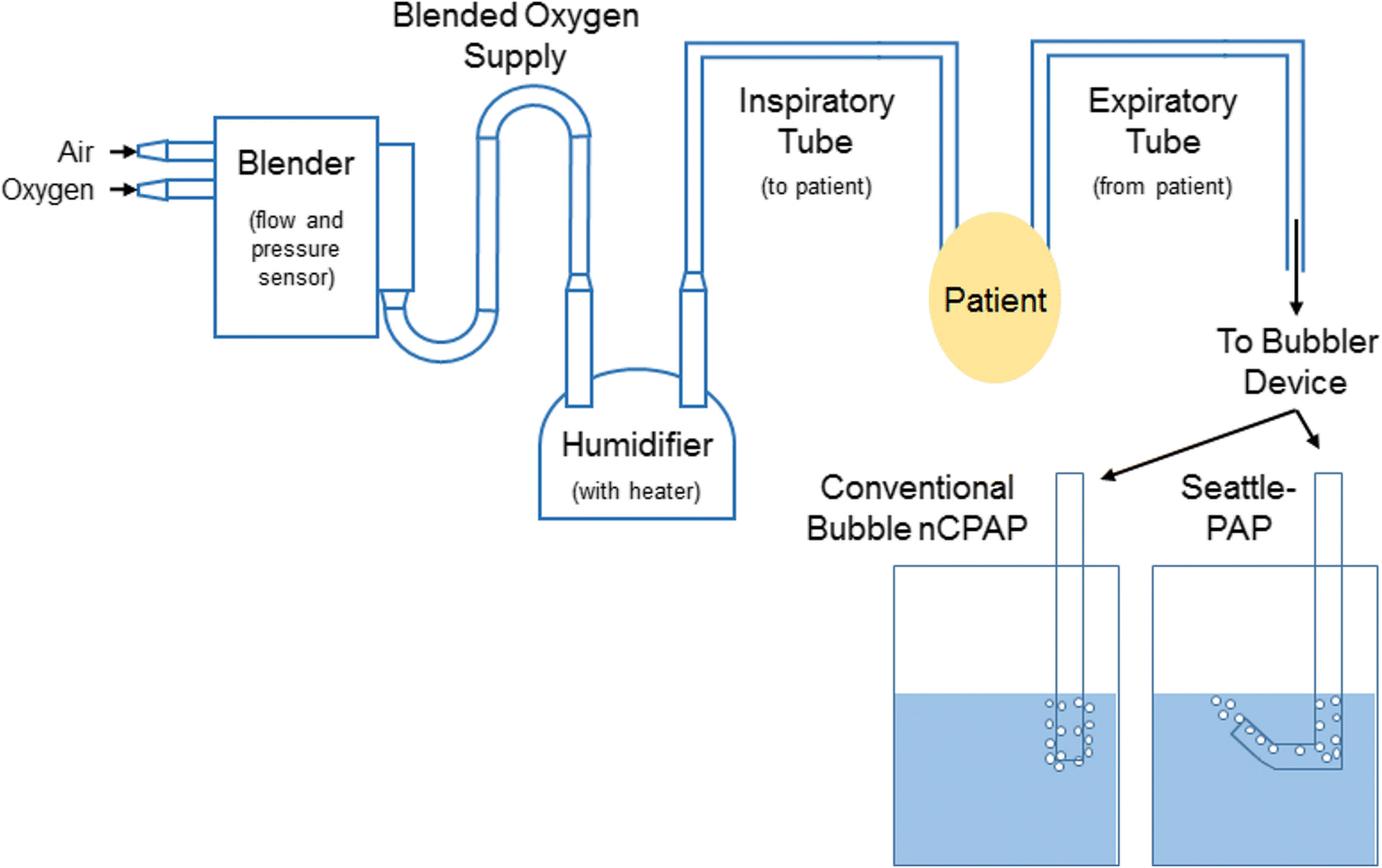 Evaluating the efficacy of Seattle-PAP for the respiratory support of ...