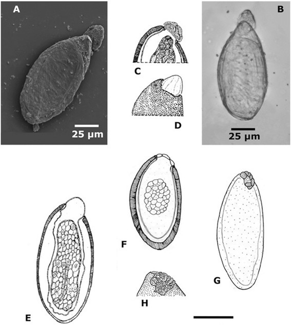 Discovery of a 240 million year old nematode parasite egg in a cynodont ...