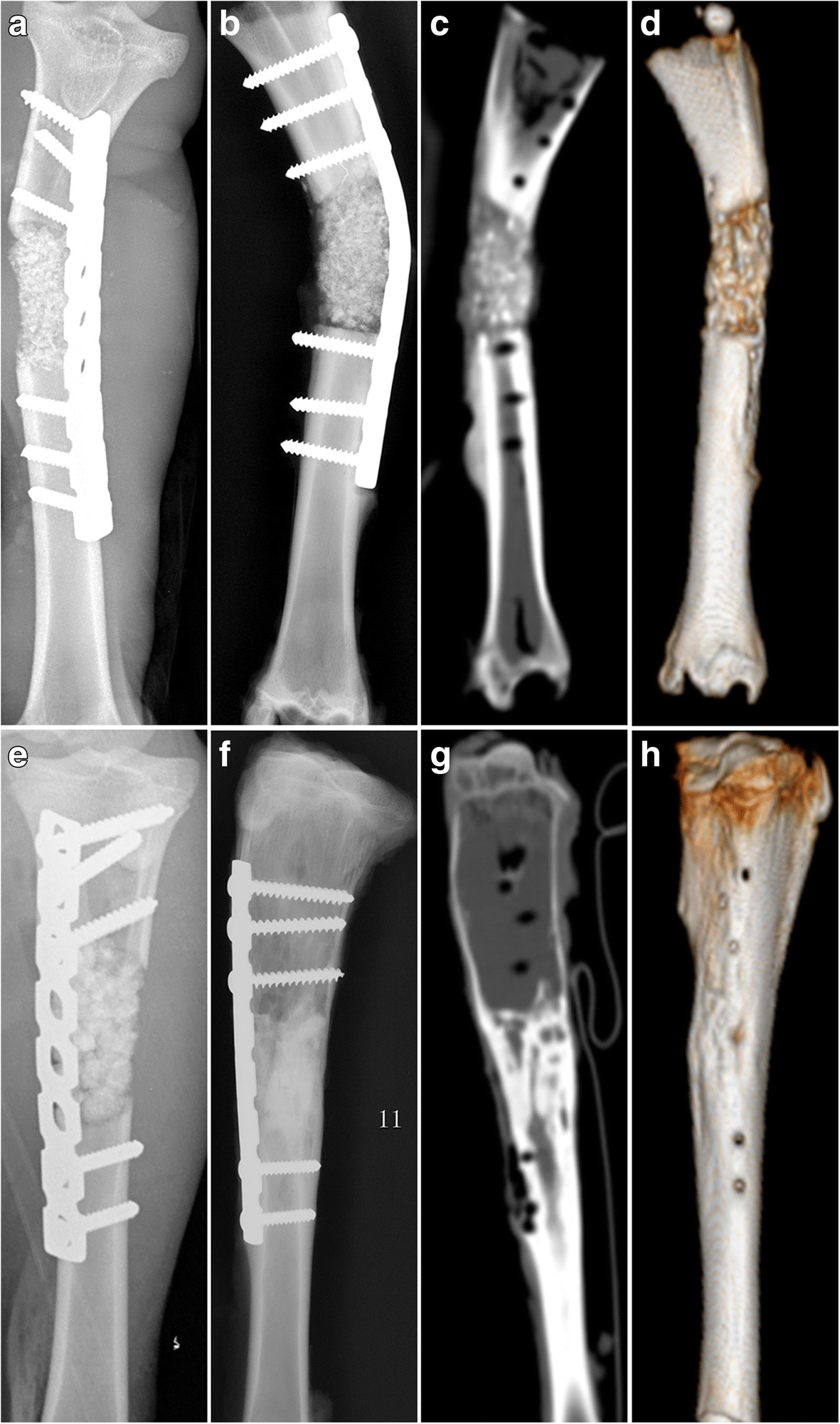 Mesenchymal stem cells and porous β-tricalcium phosphate composites ...