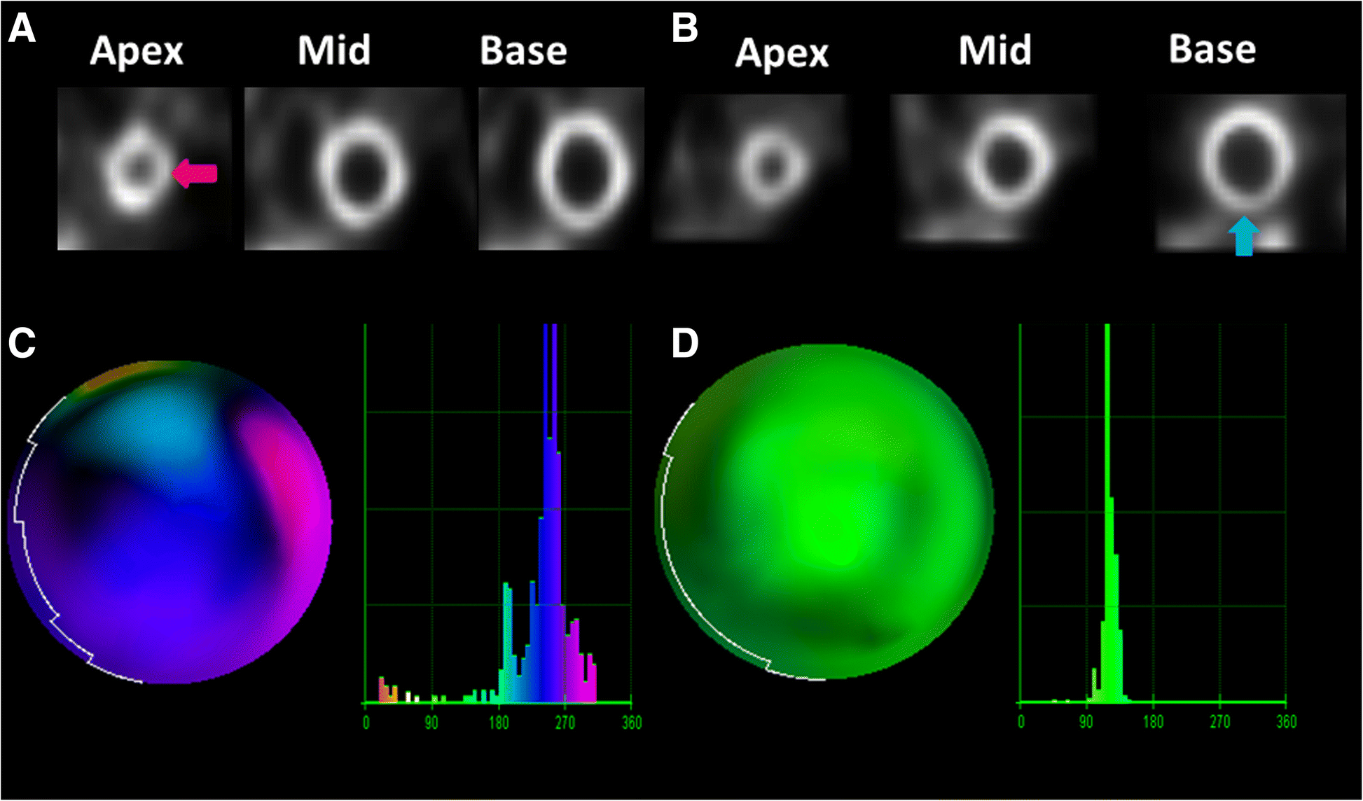 Phase analysis single-photon emission computed tomography (SPECT ...