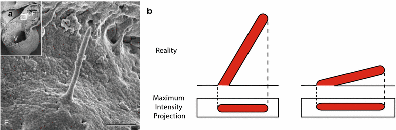 Measuring the primary cilium length: improved method for unbiased high ...