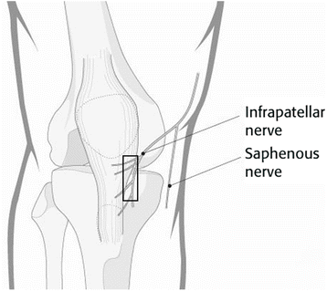 Development and validation of a new method for locating patella sensory ...