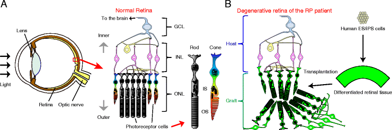 Retinal regeneration by transplantation of retinal tissue derived from ...
