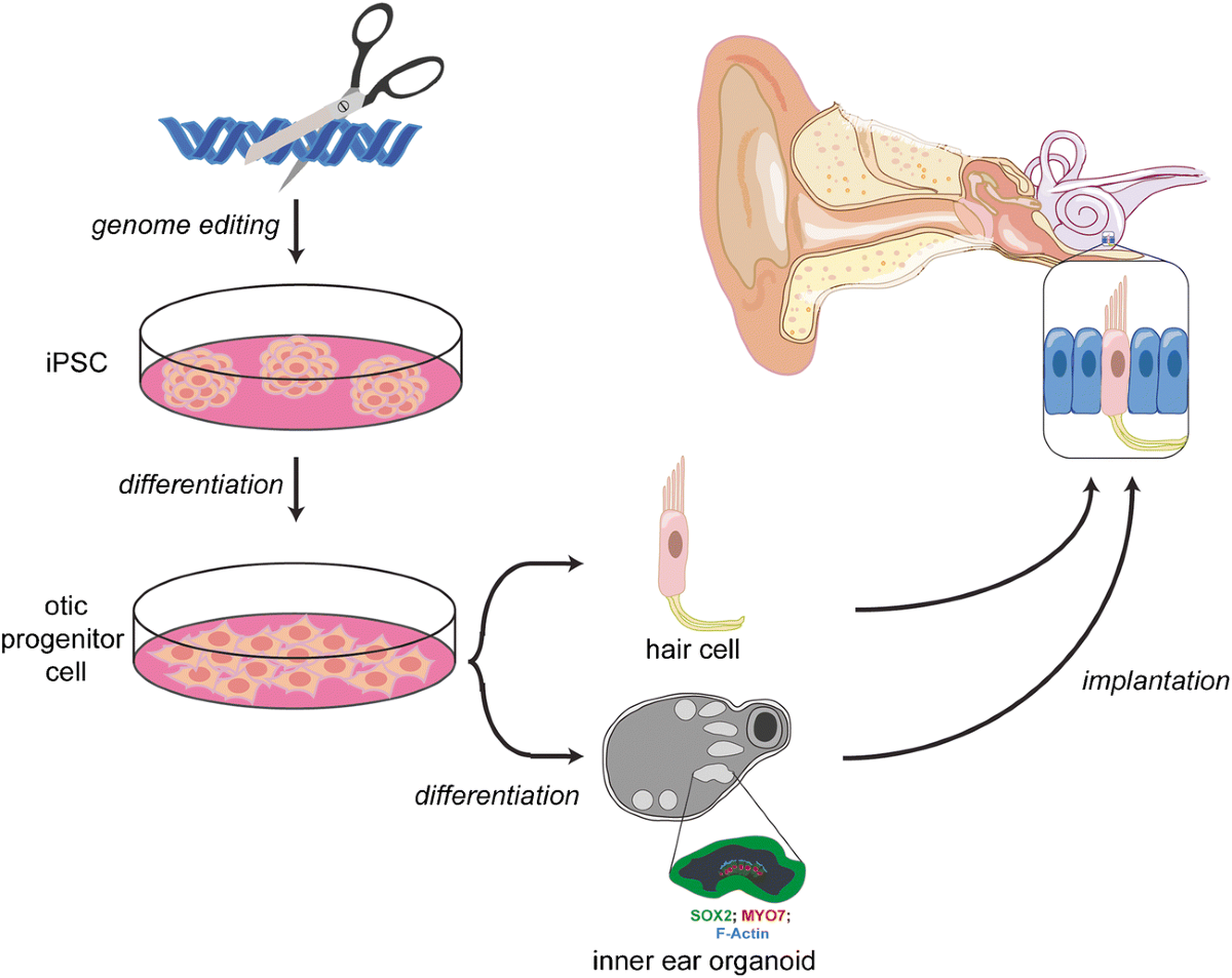 Stem Cell Breakthrough: Restoring Hearing to the Deaf – New and Tips