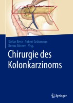 Linke Kolonflexur: Onkologische Resektion und Varianten in der ...