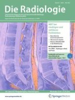 MRT der Leber | springermedizin.de