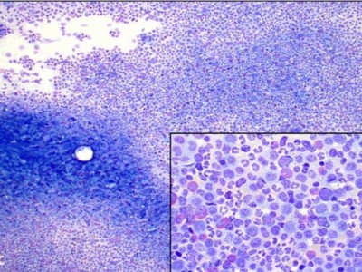Expression of Nestin associates with BRCA1 mutations, a basal-like ...
