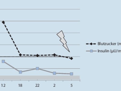 Akromegalie | Funktionsdiagnostik in der Endokrinologie ...