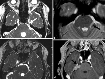 Postoperative Schmerztherapie | Piritramid | springermedizin.de