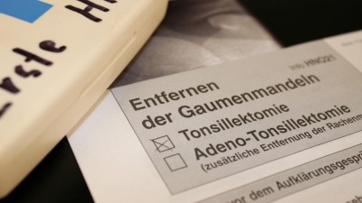 Intrakapsuläre Tonsillektomie überzeugt bei allen Indikationen ...
