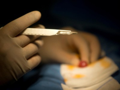 Phimose | Aktualisierte Handlungsempfehlung zur S2k-Leitlinie „Phimose ...