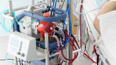 Body position makes no difference to outcomes during ECMO for severe ...