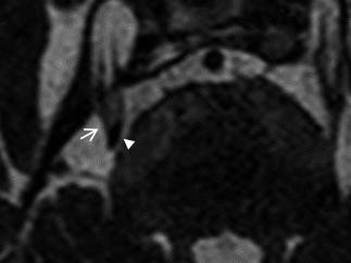 Postoperative Schmerztherapie | Piritramid | springermedizin.de