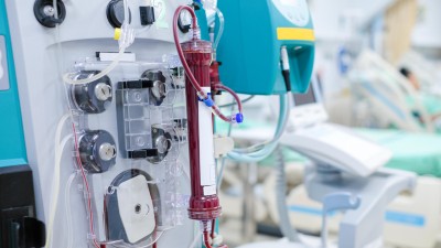 Extracorporeal blood purification reduces acute kidney injury after ...