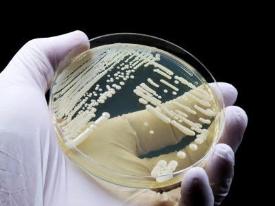 Candida-Mykosen | Candida auris: Der richtige Umgang mit einem ...