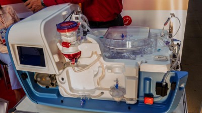 Real-world data show benefits of normothermic machine perfusion in ...